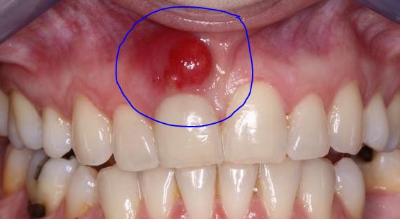 Got a question about cancer - NeoGAF