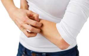 Chlorine Allergy Rash Pictures, Symptoms, Treatment and Remedies ...